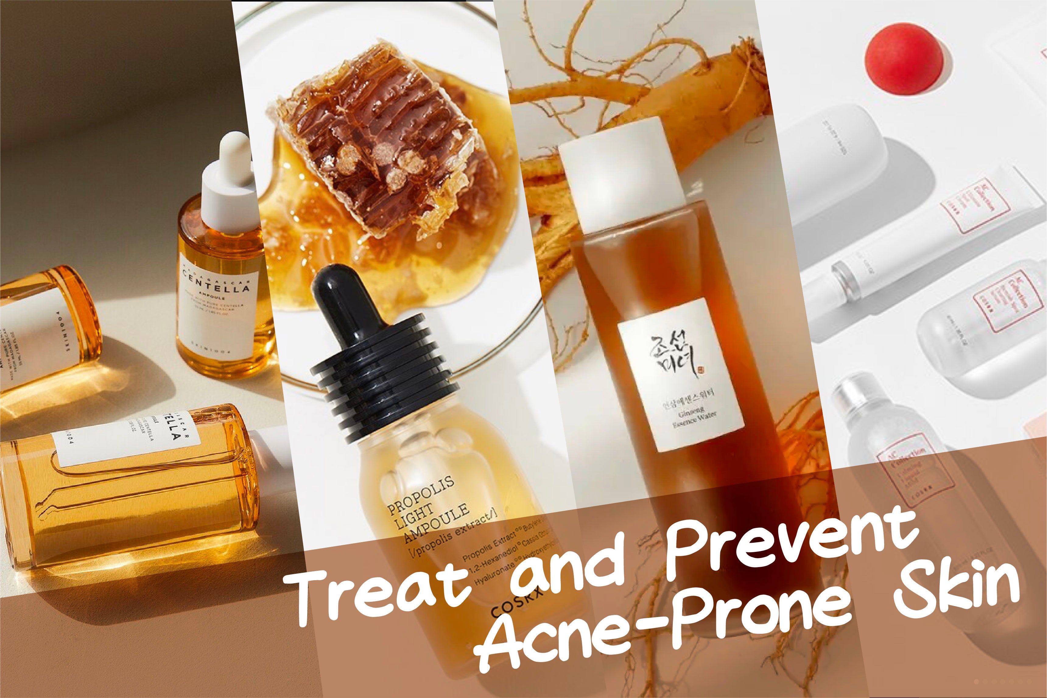 The Guide to Caring for Acne-Prone Skin – LAMOUR Beauty & Life